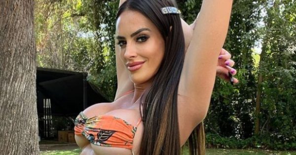«Que rara se ve la pierna»: Adriana Barrientos recibió duros comentarios de sus seguidores tras ...