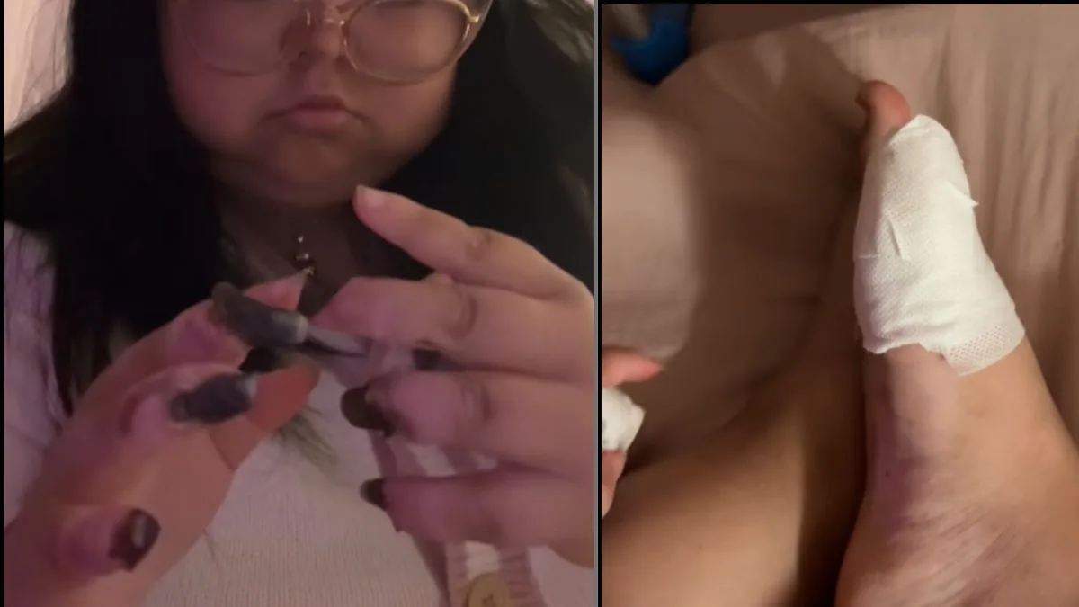 ¡Impactante! Famosa influencer chilena pierde parte de sus dedos por ...